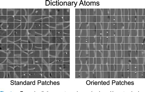 Figure 3 From Segmenting The Brain Surface From Ct Images With Artifacts Using Locally Oriented