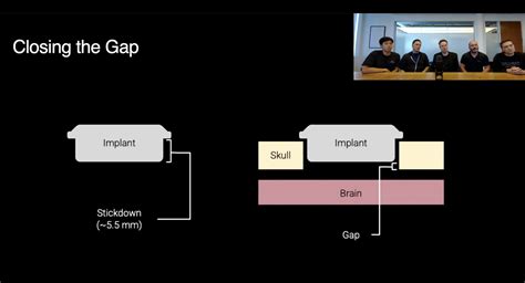 Heres How Neuralink Is Modifying Its Brain Chip For Second Human Patient
