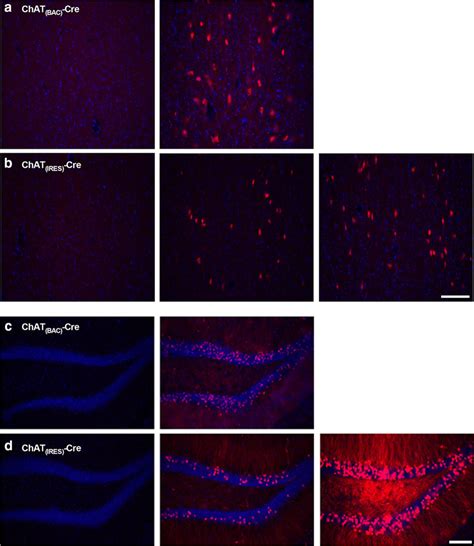 Expression Of Cre Driven Tdtomato Fluorescence In The Septum And