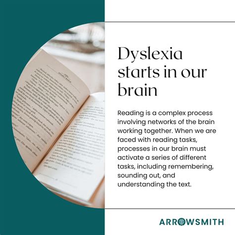 Barbara Arrowsmith Young She Her On Linkedin Edadyslexiaday Dyslexia