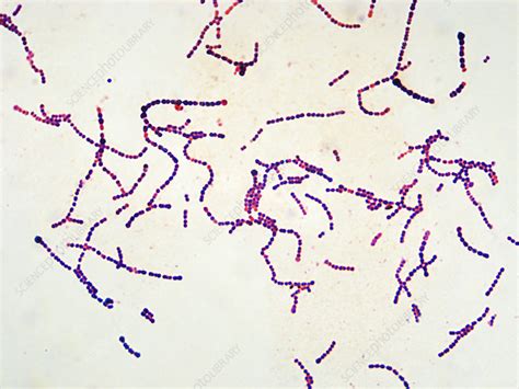 Streptococcus Pneumoniae Bacteria Stock Image B236 0159 Science Photo Library