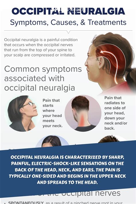 Occipital Neuralgia Exercises Stretches For Occipital Neuralgia Artofit