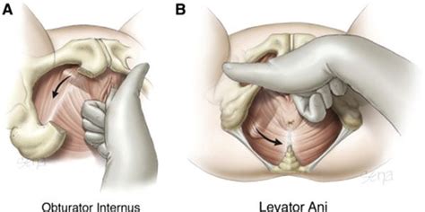 Pelvic Floor Trigger Points Diagram
