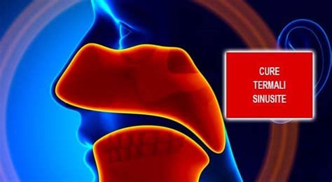 Cure Termali Per Sinusite Cronica Montecatini Terme Toscana