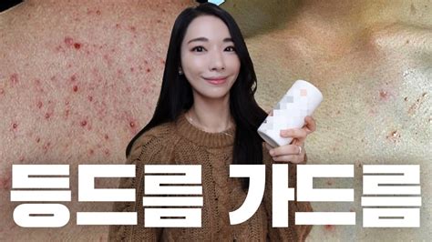 2가지만 기억하면 됩니다 ㅣ등드름 가드름 없애는 법ㅣ등드름 바디워시 Youtube