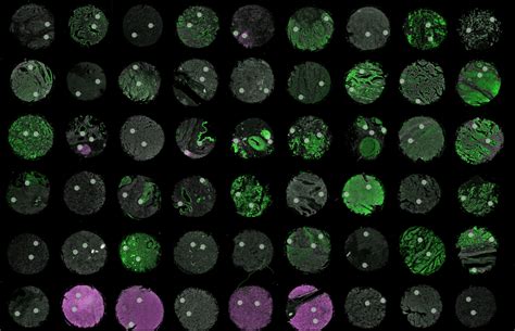 Geomx® Io Proteome Atlas Nanostring