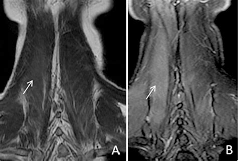 Figure 1 From Use Of Chemical Shift Encoded Magnetic Resonance Imaging Cse Mri For High