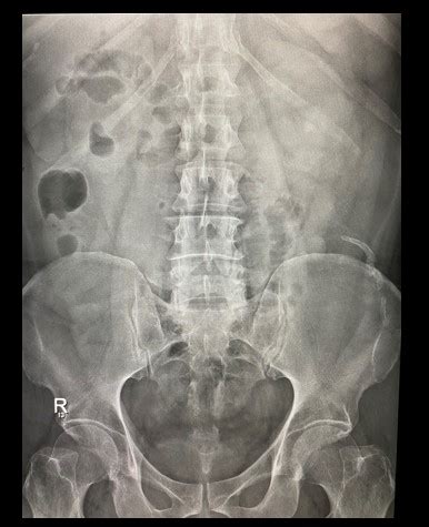 Image Radiopaedia Org