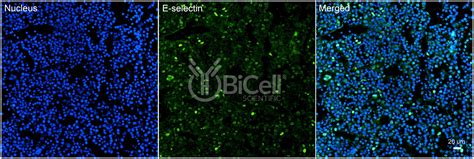 E Selectin Sele Or Lecam2 Or Cd62e Antibody Bicell Scientific®