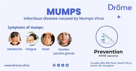 Mumps Causes Symptoms And Treatments Drome Clinic