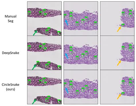 Qualitative Results This Figure Shows The Qualitative Segmentation
