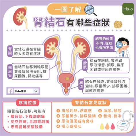 網傳「華晨宇演唱會震碎腎石」︱專家：僅靠現場聲波不足以震碎結石 多倫多 加拿大中文新聞網 加拿大星島日報 Canada