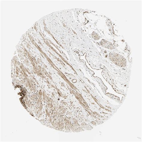 Eea1 Staining In Prostate Glandular Cells Source Frontal Cortex