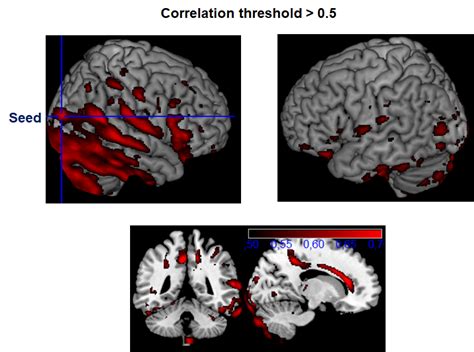 Spatial Coding And Similar Spatial Patterns In The Brain Part 2 General Neuroscience