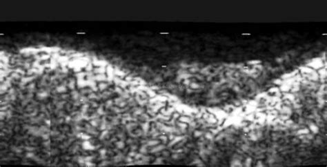 【算法opencv】图像极坐标变换及基于opencv的实现极坐标扭曲算法 Csdn博客