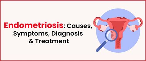Endometriosis Causes And Symptoms Menstrual Cramps Or Endometriosis