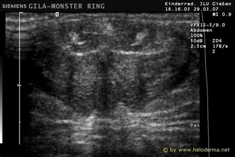 Sexes Of Heloderma