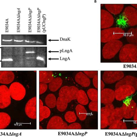 Function Of CS CFA III And TCP Proteins Download Table