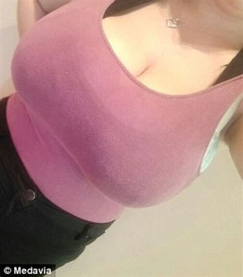 Memiliki Ukuran Payudara Sangat Besar Bukannya Bangga Wanita Ini Ternyata Inilah Fakta