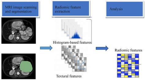 Flow Chart Of Image Processing Radiomic Features Extraction And Download Scientific Diagram