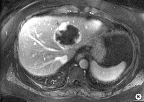 Liver Radiology Key