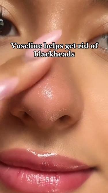 How To Shrink Large Pores On Nose Overnight Large Pores On Nose Treatment Artofit