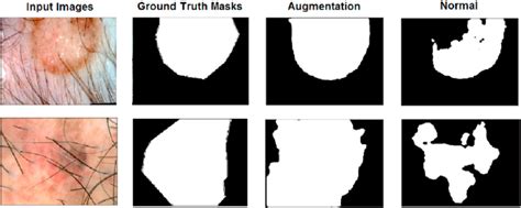 segmentation obtained from mobilenetv3 unet model training from left
