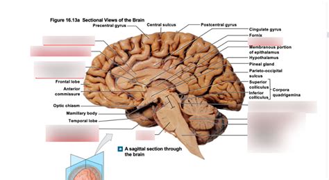 MIDTERM SAGITTAL SECTION BRAIN Diagram Quizlet