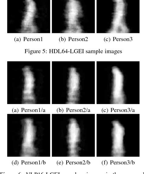 Figure 1 From Gait Recognition With Compact Lidar Sensors Semantic Scholar