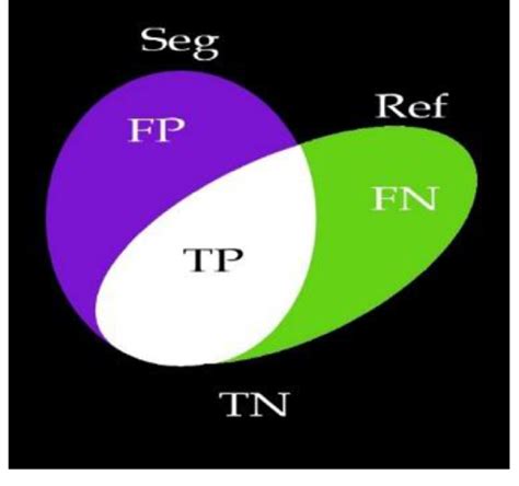 Figure 2 From Multiple Sclerosis Lesions Segmentation In Magnetic Resonance Imaging Using