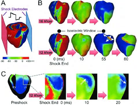 Fibrillation Induction Following External Biphasic Shock Download Scientific Diagram