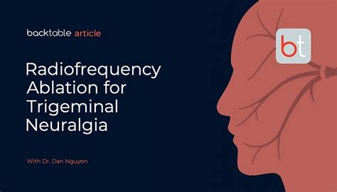 Radiofrequency Ablation For Trigeminal Neuralgia