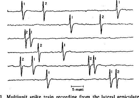 Figure 1 From Real Time Classification Of Multiunit Neural Signals