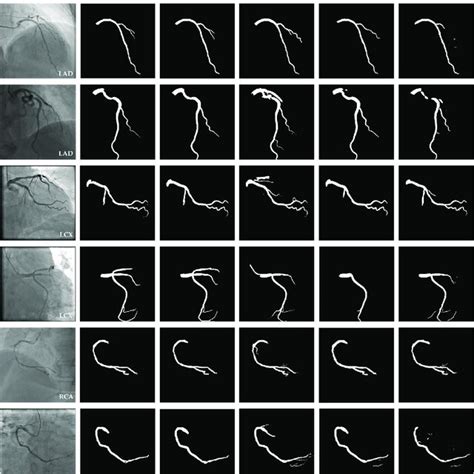 Representative Examples Of Vessel Segmentation The First Column Download Scientific Diagram