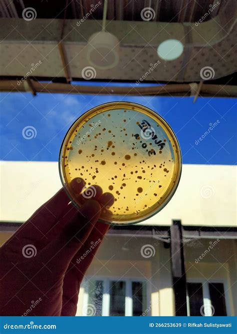 Total Plate Count Bacteria Stock Image Image Of Sign 266253639