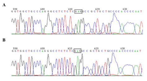 The Sequence Analysis Of The Deletion Breakpoints In Two Patients A Download Scientific