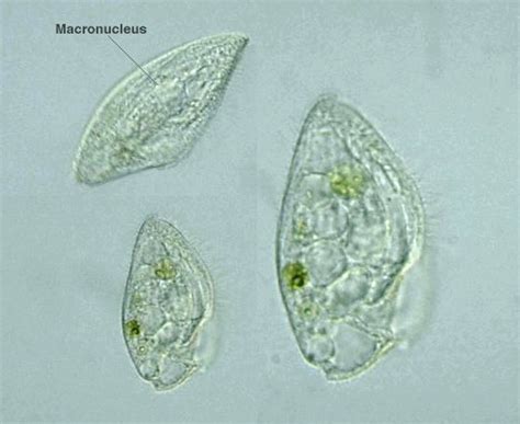 Protist Images Blepharisma Lateritium