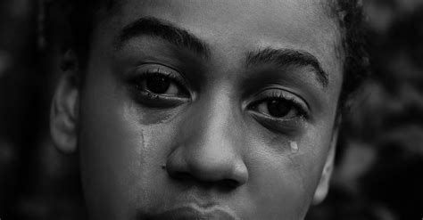 How To Stop Scalp Inflammation Merelta