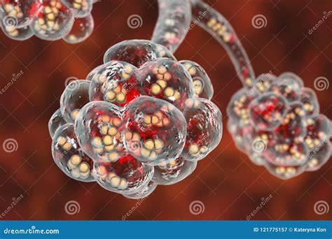 Pneumococcal Pneumonia Medical Concept Stock Illustration Illustration Of Biology Physiology