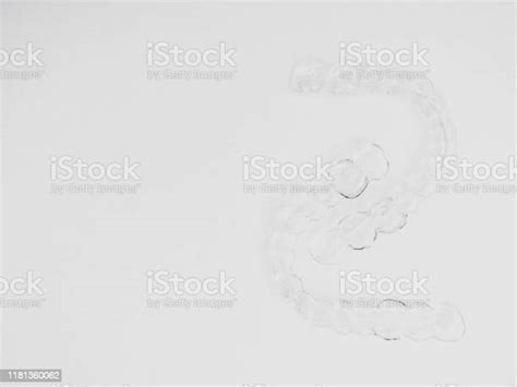 투명 중괄호 또는 정렬기 아름다운 미소와 하얀 이빨을 가질 수있는 방법 건강관리와 의술에 대한 스톡 사진 및 기타 이미지 건강관리와 의술 구별하기 힘든 라트비아