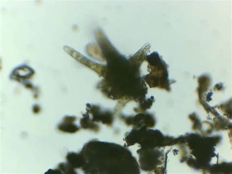 Is This A Moss Protonema R Botany