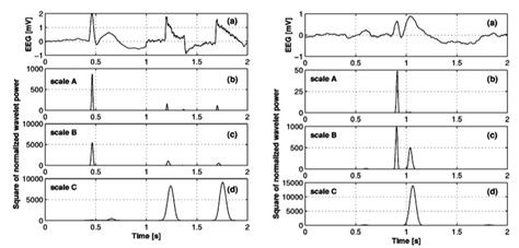 Applications Of Wavelets In Eeg Sapien Labs Shaping The Future Of