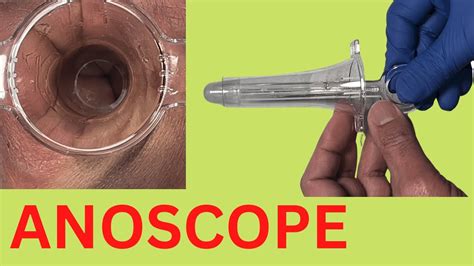 How Does An ANOSCOPE Work YouTube