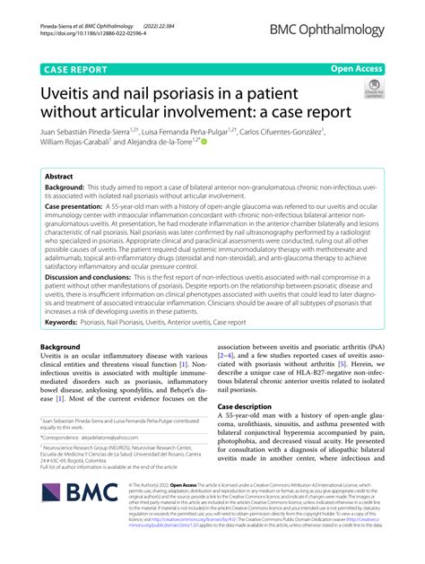 Pdf Uveitis And Nail Psoriasis In A Patient Without Articular