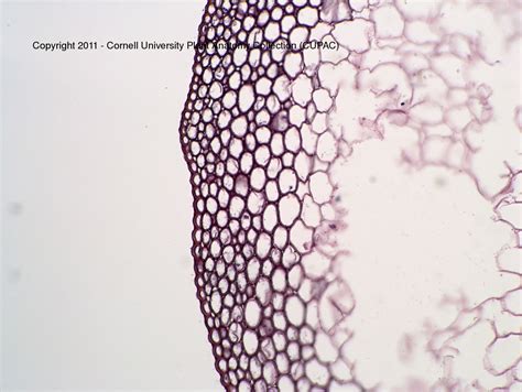 Collenchyma Slide