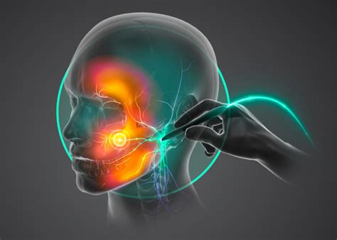 Pulse Radio Frequency Therapy Toronto Toronto Physio Therapy