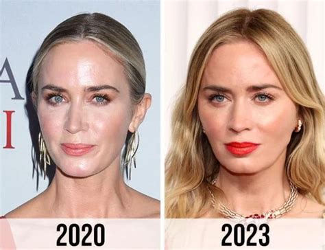 Emily Blunt Plastic Surgery Fact Or Fiction