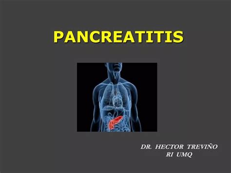 Ppt Pancreatitis Powerpoint Presentation Free Download Id1949212