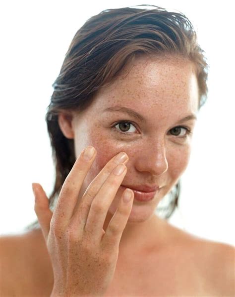 Melasma Treatments How To Know Which One Is Right For You Dr Jinah Yoo