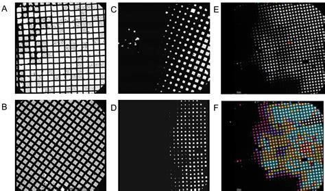 Video Single Particle Cryo Electron Microscopy From Sample To Structure